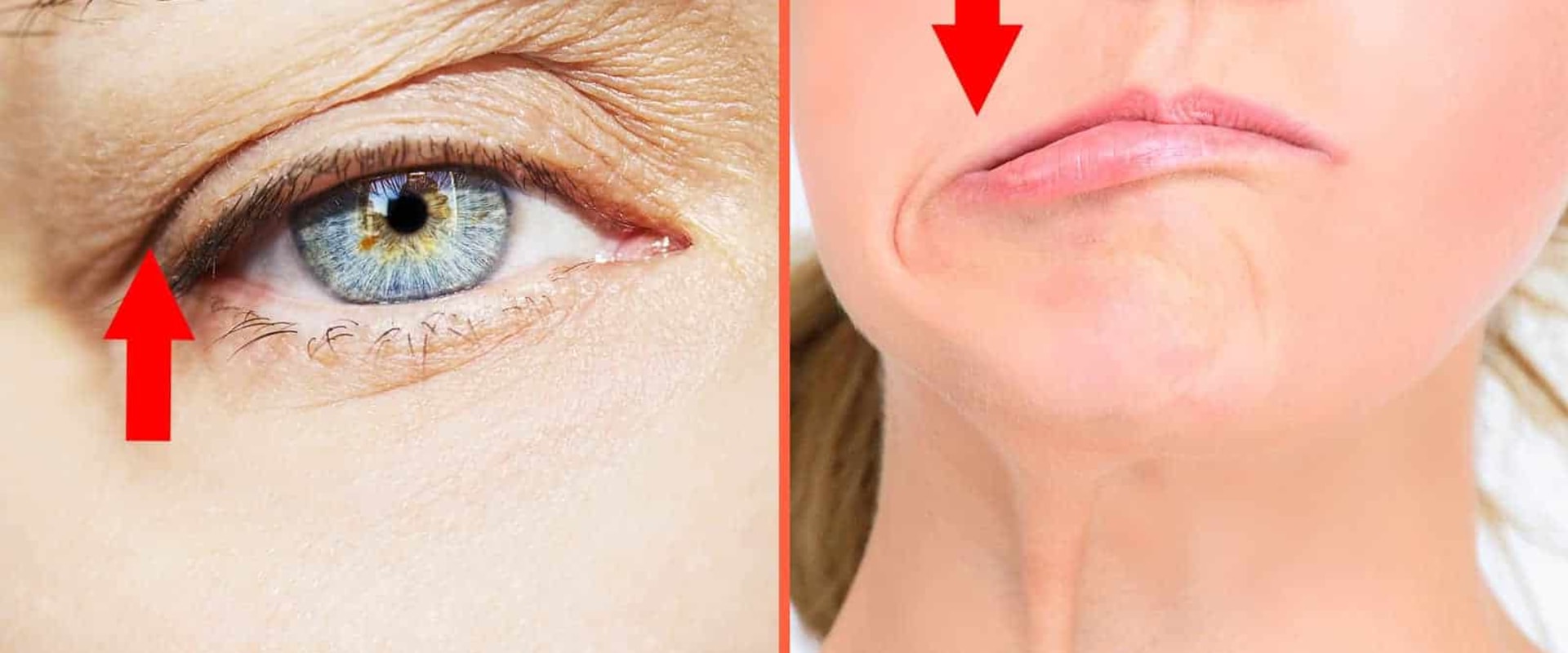 What are the Long-Term Effects of Botox?